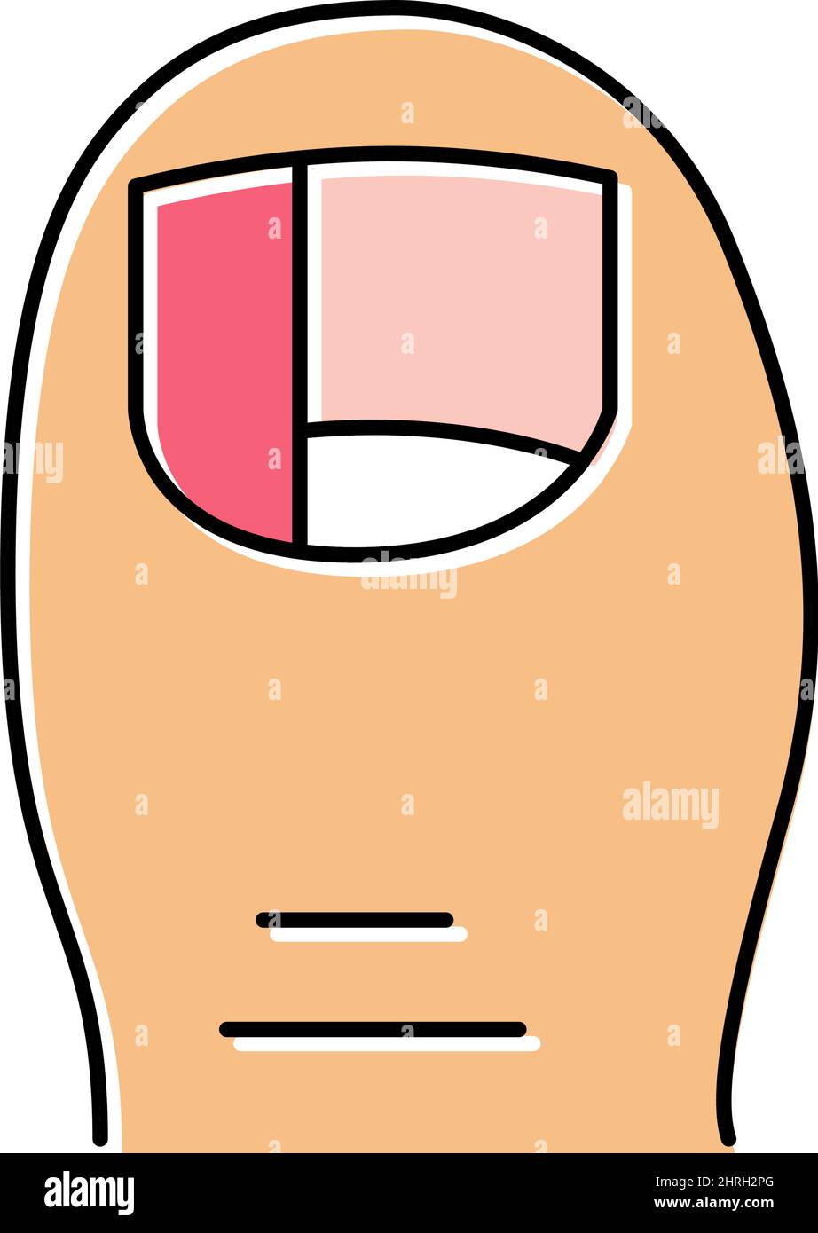 cut nail medical treatment color icon vector illustration Stock Vector ...