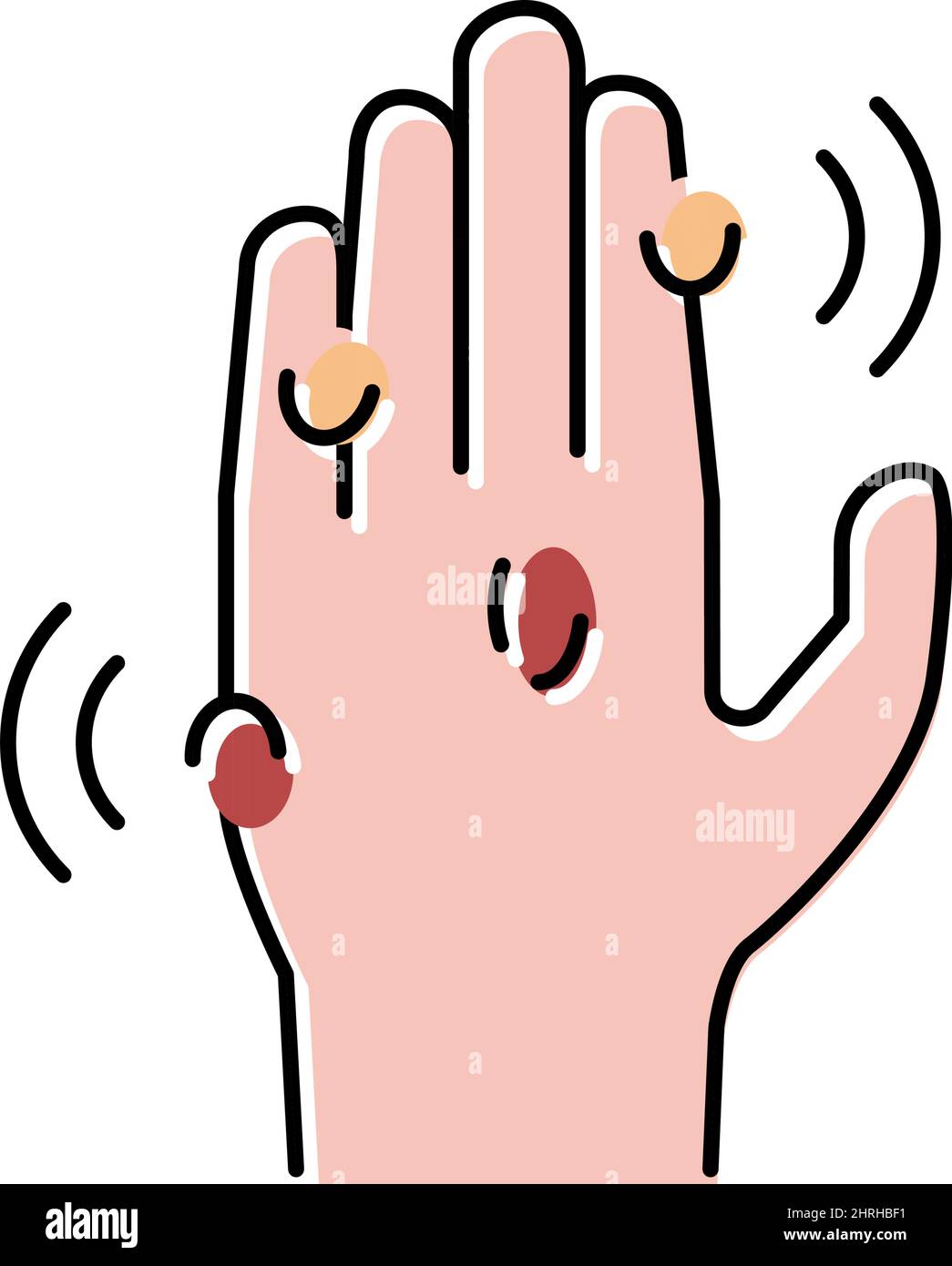 warts disease color icon vector illustration Stock Vector Image & Art ...