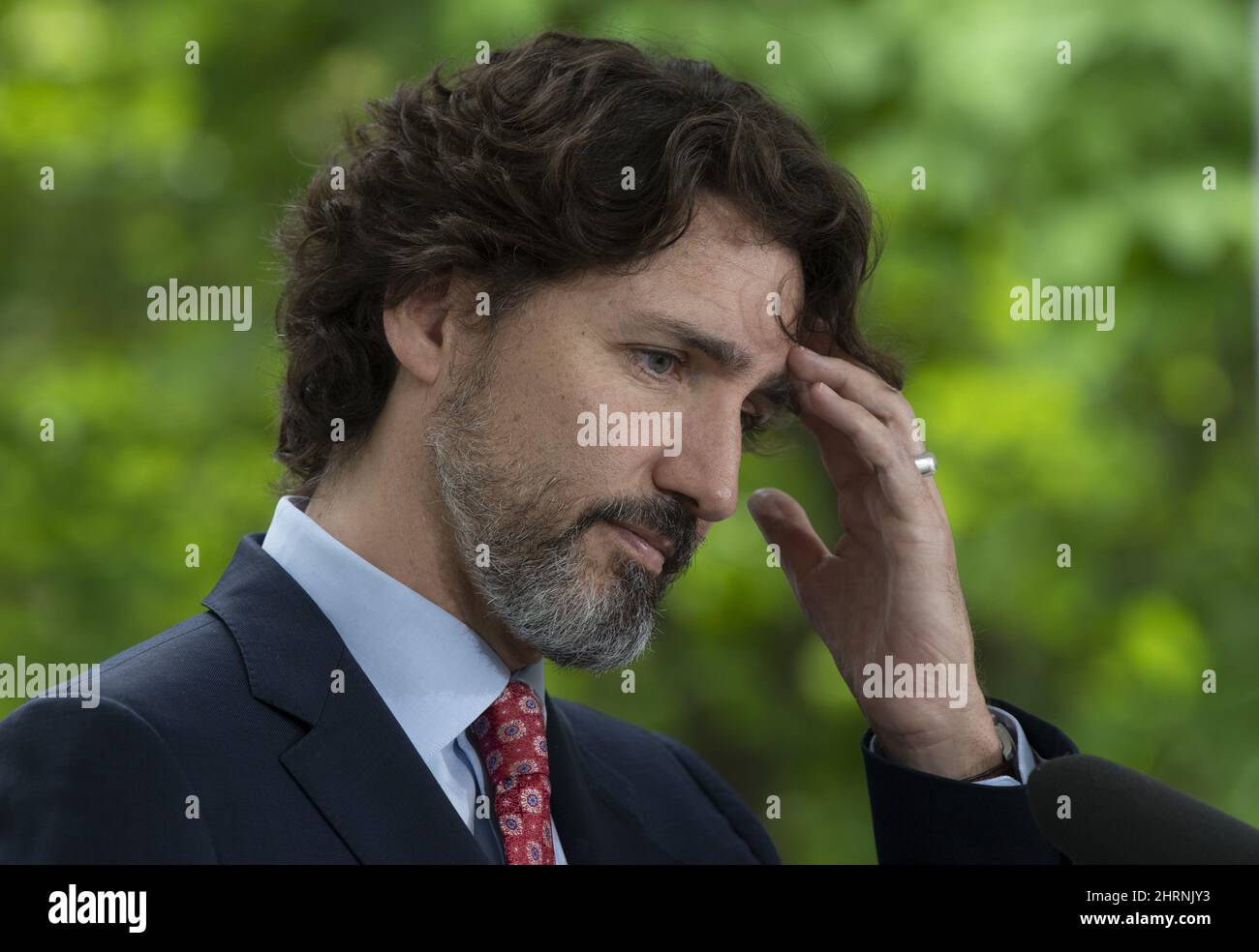Prime Minister Justin Trudeau touches his forehead during a news ...