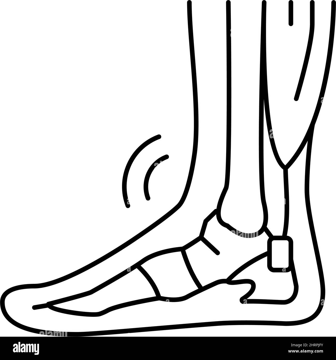 Achilles Tendon Tendinopathy Tendonitis Fat Pad Disorders Foot ...