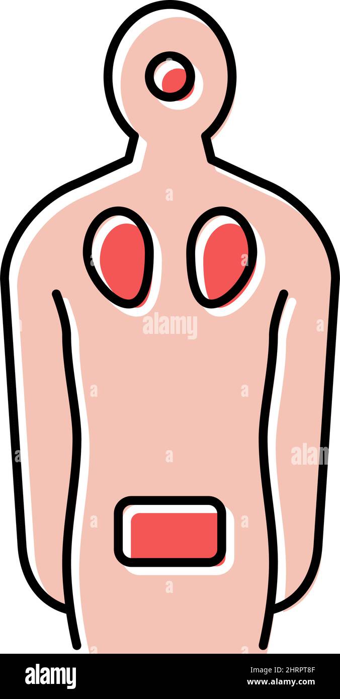 decubitus ulcers disease color icon vector illustration Stock Vector ...