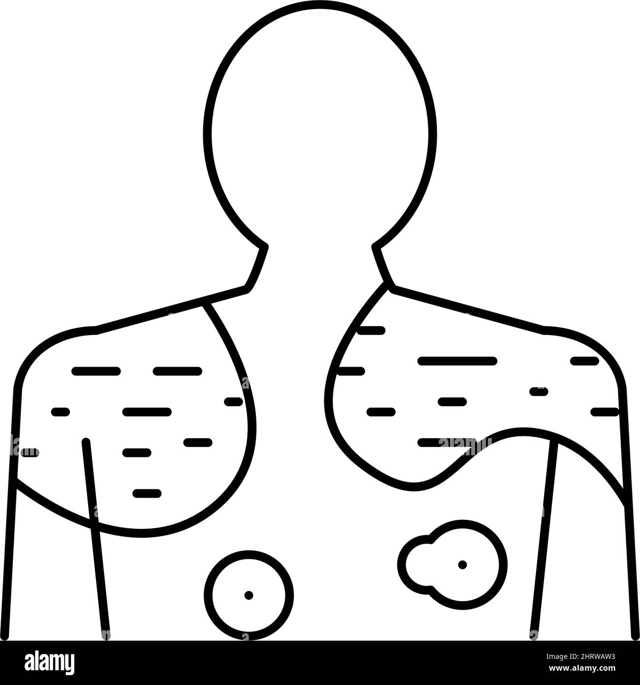 psoriasis disease line icon vector illustration Stock Vector Image ...