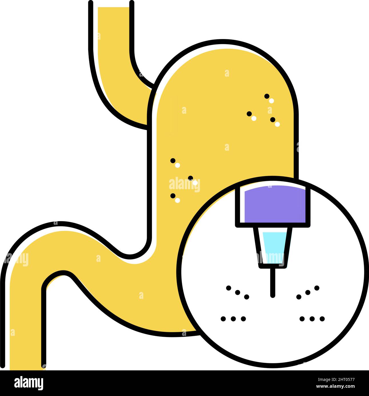 Stomach laser medical treatment color hi-res stock photography and ...