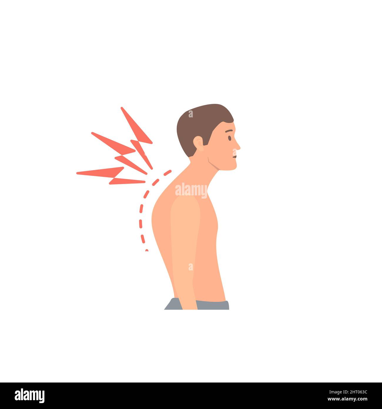 Poor posture, illustration Stock Photo - Alamy