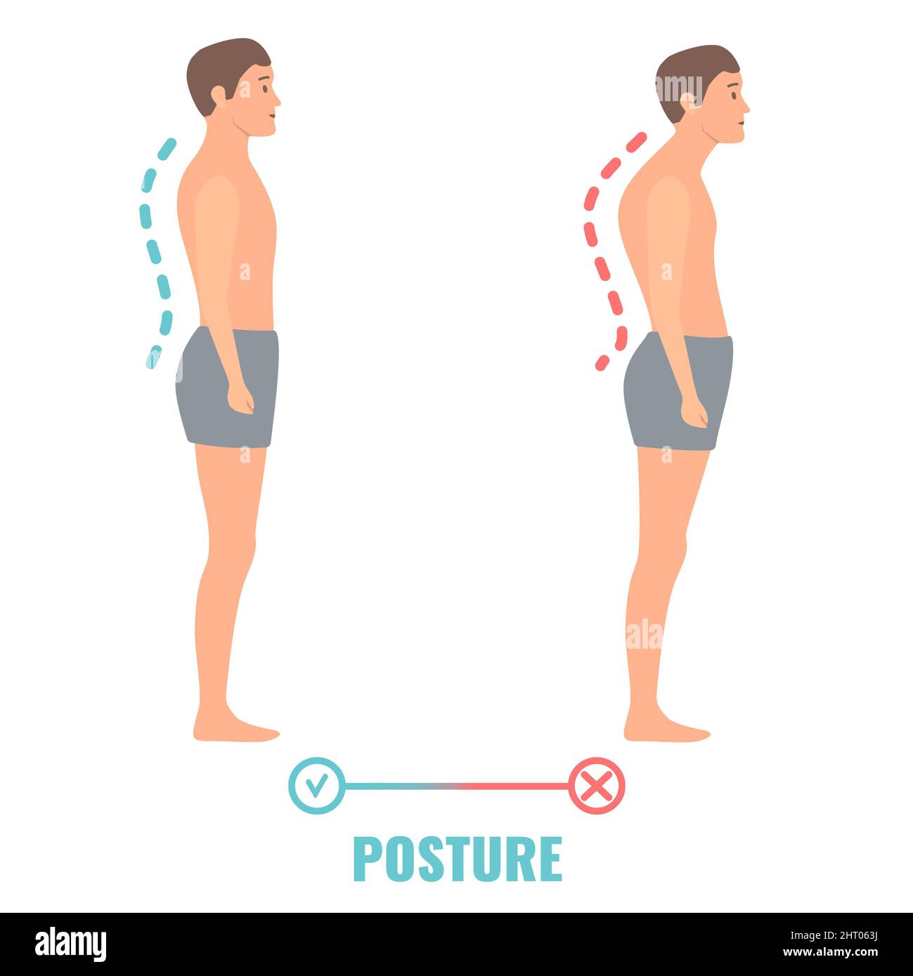 Good and bad posture, conceptual illustration Stock Photo - Alamy Good and bad posture, conceptual illustration Stock Photo - Alamy