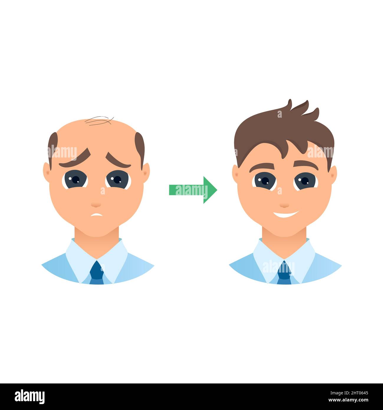 Alopecia treatment, conceptual illustration Stock Photo - Alamy