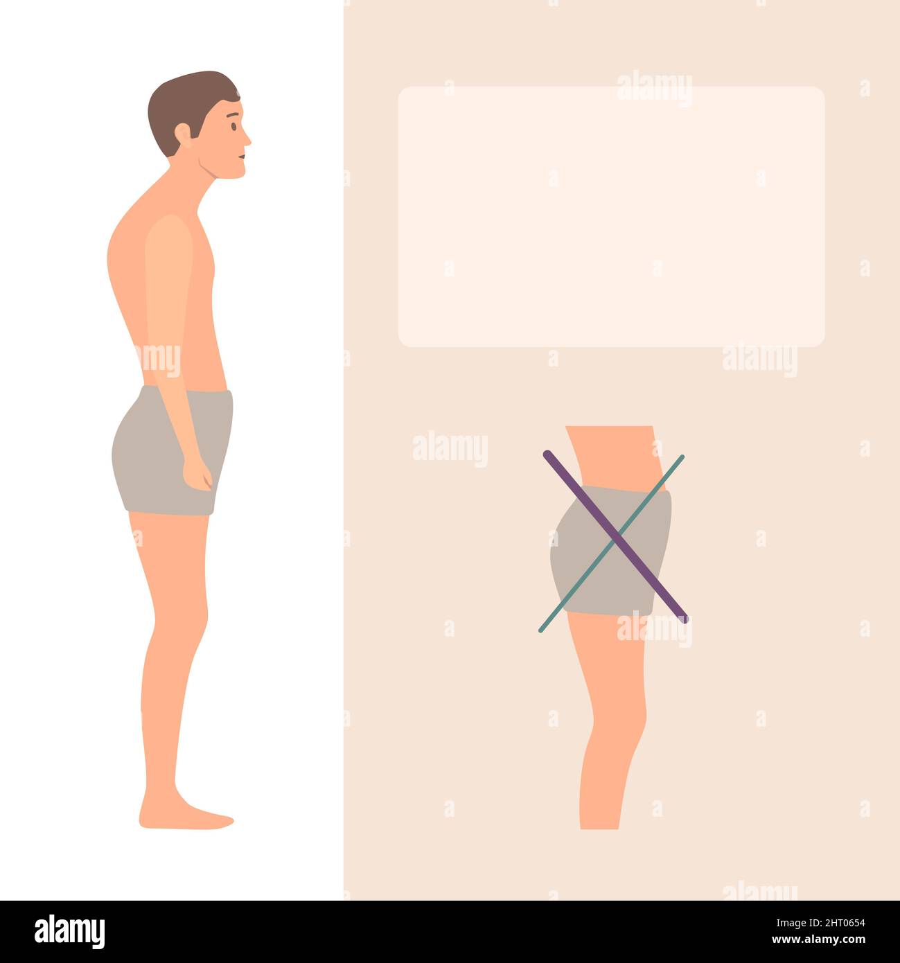Upper crossed syndrome, conceptual illustration Stock Photo - Alamy
