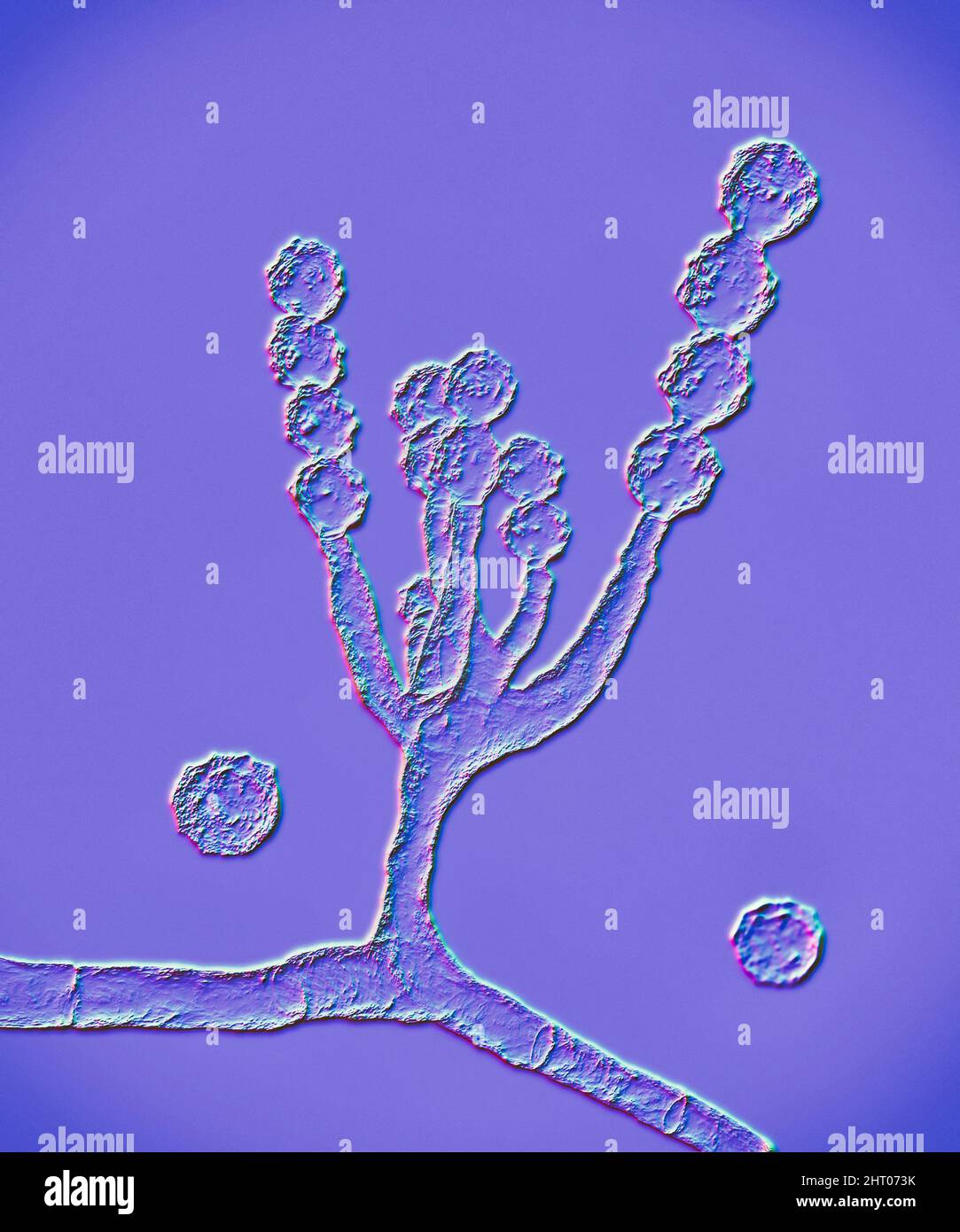 Scopulariopsis brevicaulis fungus, illustration Stock Photo - Alamy