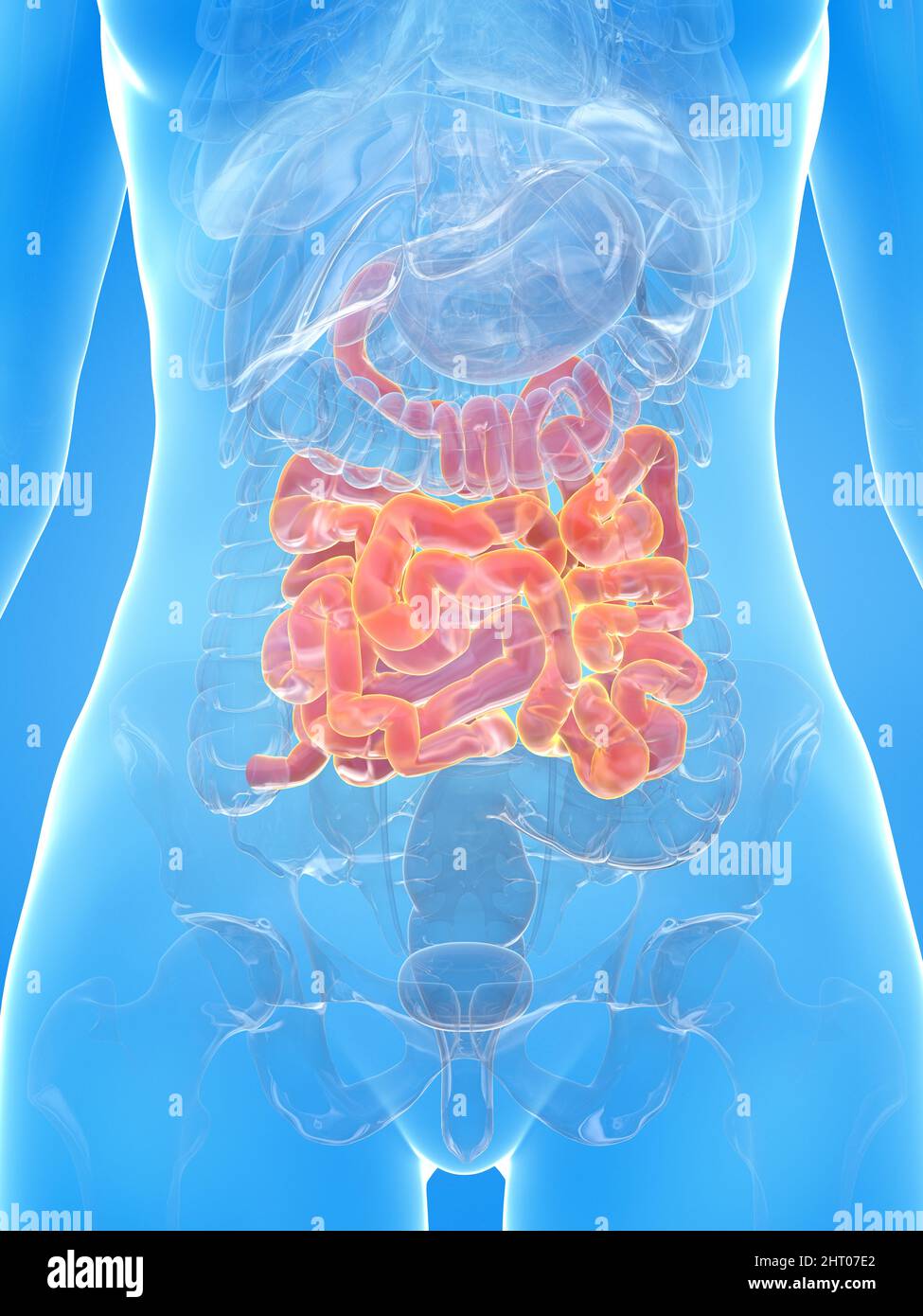 Small bowel obstruction hi-res stock photography and images - Alamy