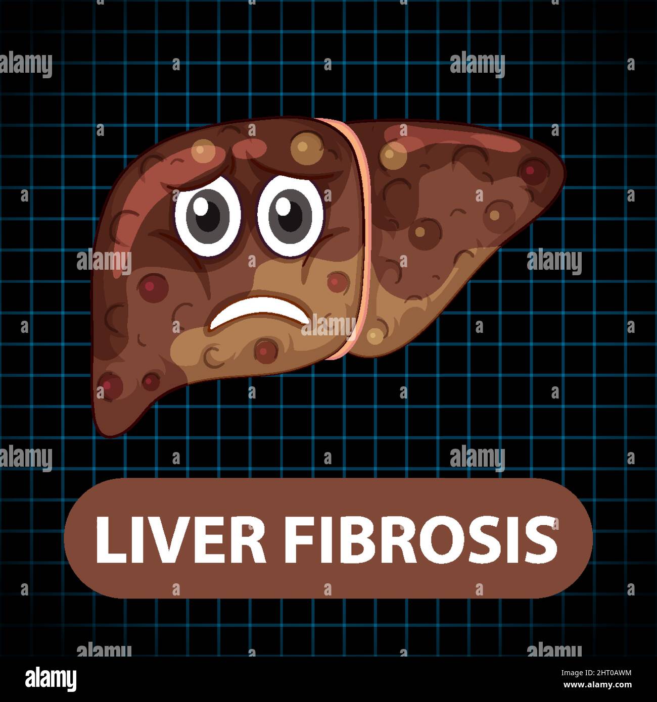 Liver fibrosis cartoon character illustration Stock Vector Image & Art ...