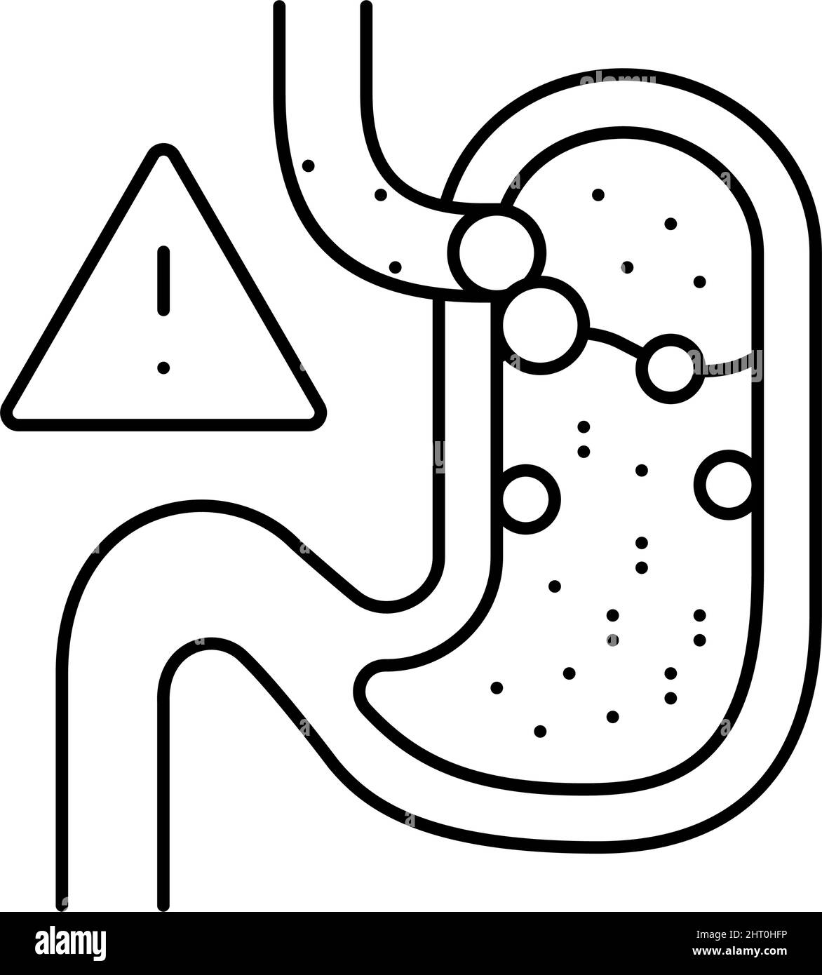 Gastric reconstruction hi-res stock photography and images - Alamy