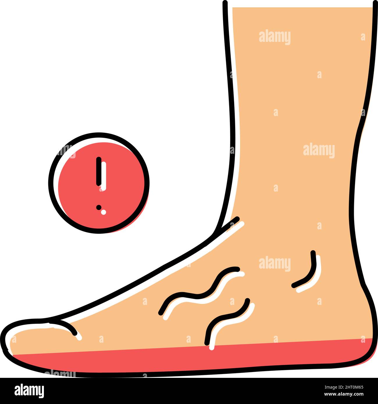 disease flat feet color icon vector illustration Stock Vector Image ...