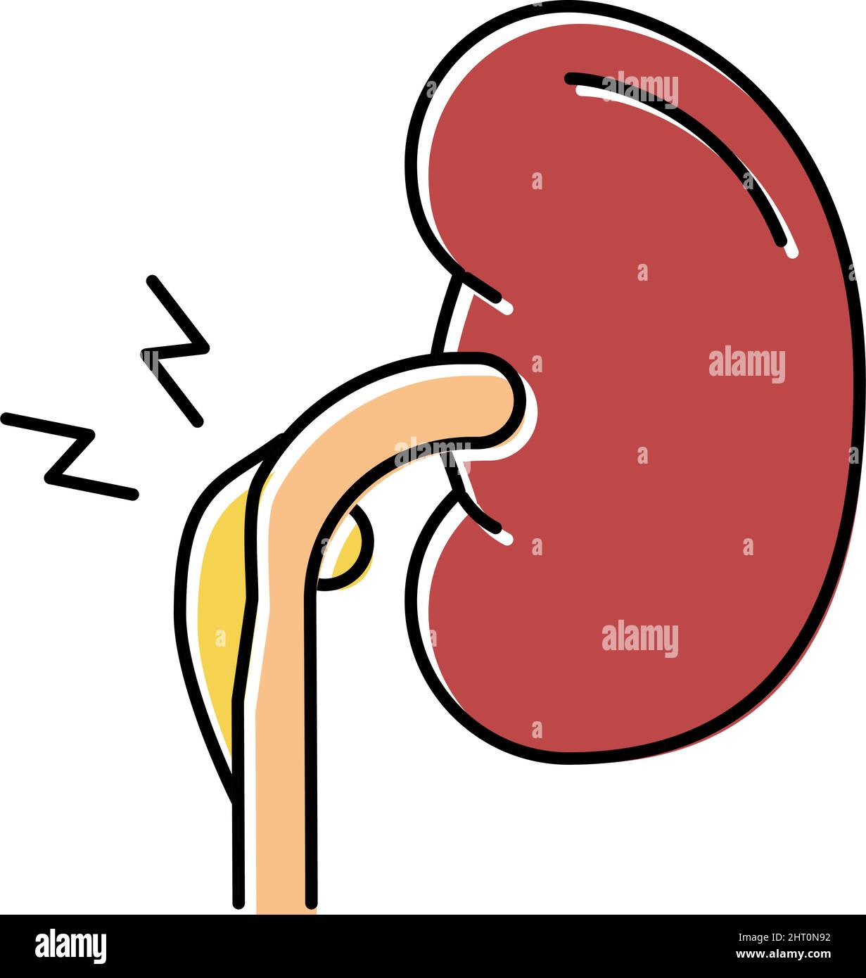 nephritic syndrome color icon vector illustration Stock Vector Image ...