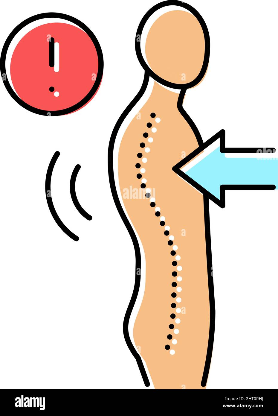 Scoliosis and kyphosis Cut Out Stock Images & Pictures - Alamy