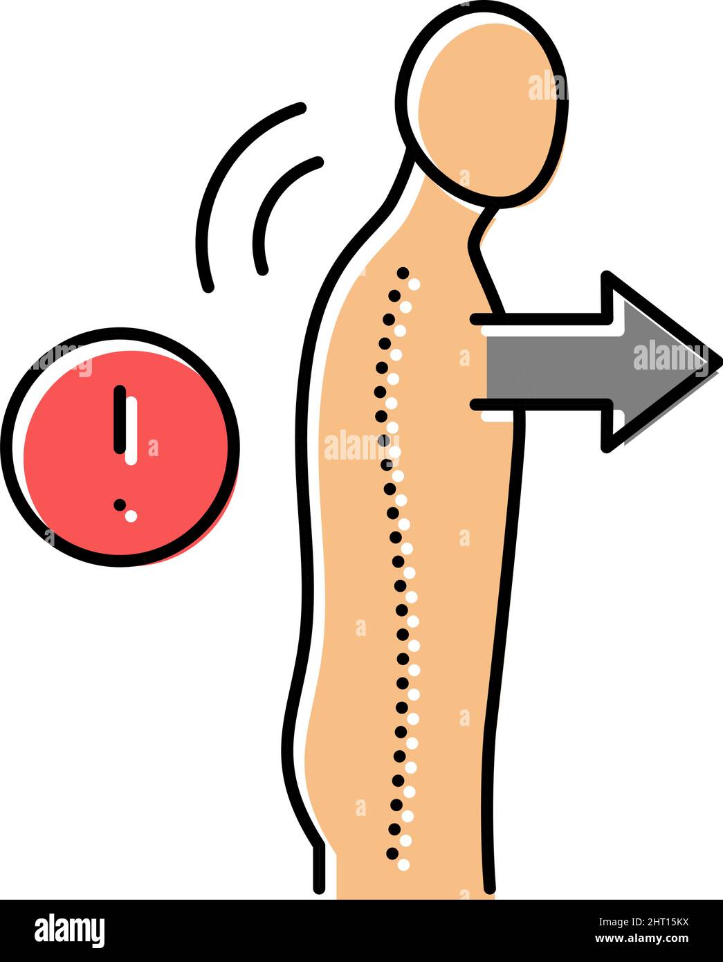 slouch scoliosis color icon vector illustration Stock Vector Image ... slouch scoliosis color icon vector illustration Stock Vector Image ...