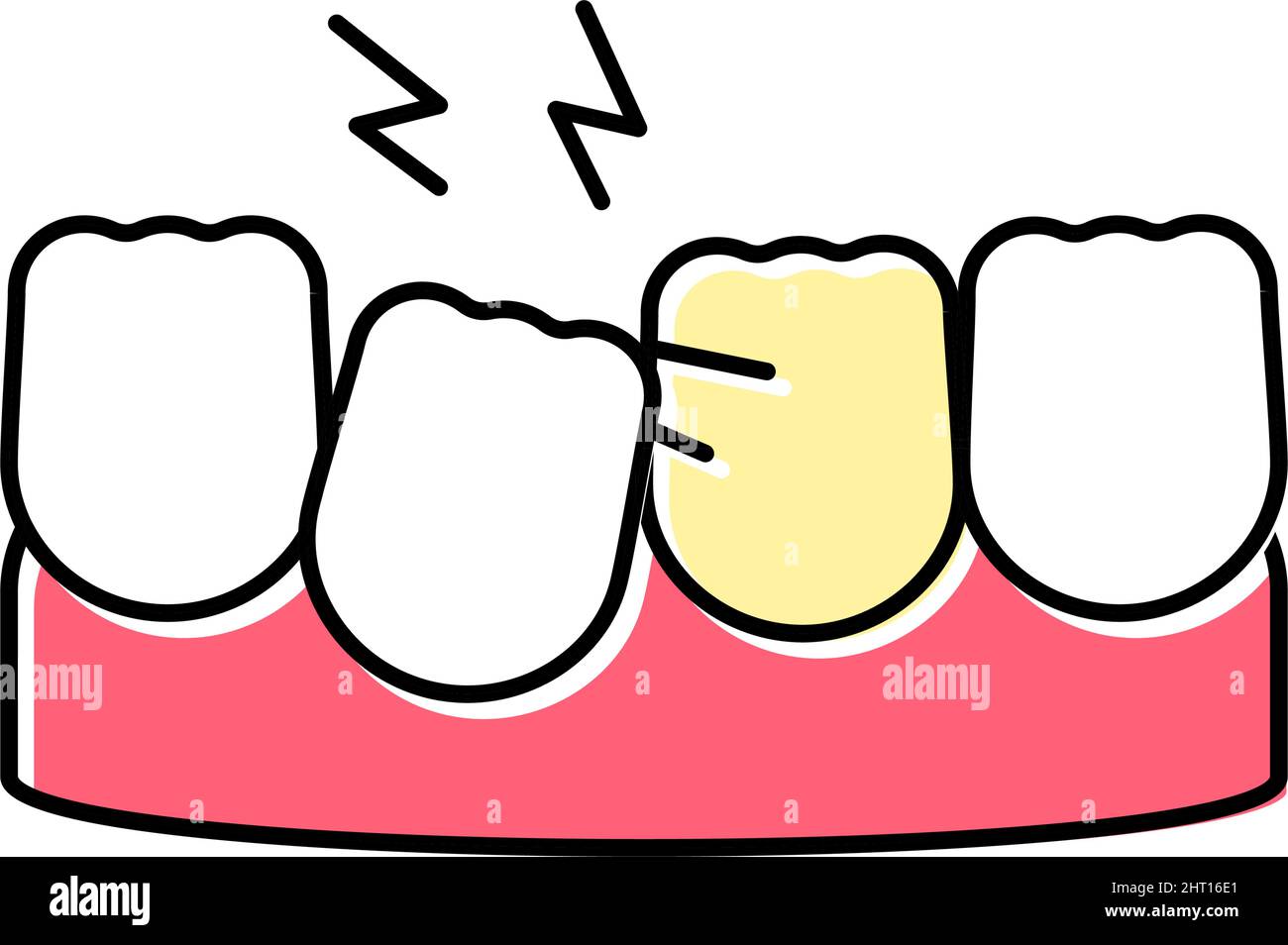 loose tooth color icon vector illustration Stock Vector Image & Art - Alamy