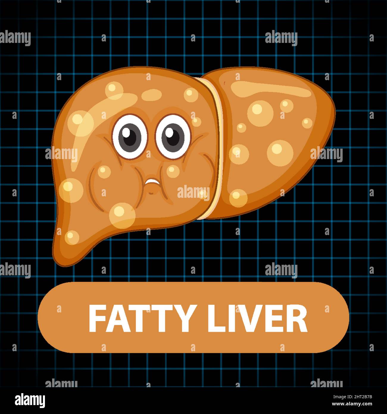 Fatty liver vector vectors Stock Vector Images - Alamy