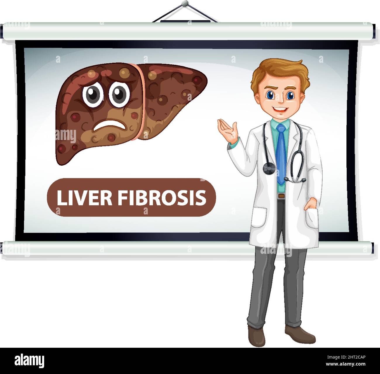A doctor cartoon character explaining fibrosis liver illustration Stock ...