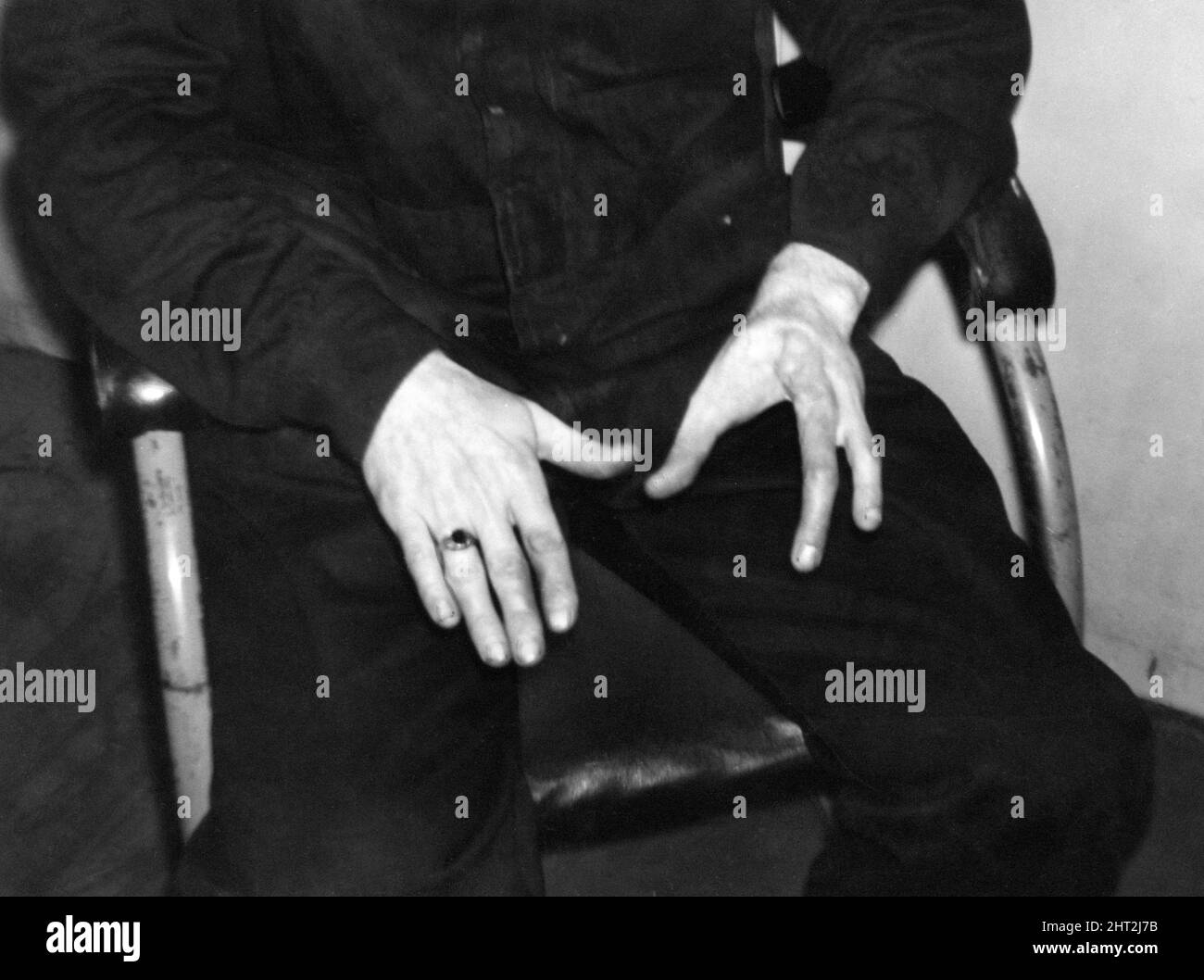 Finger accidents hi-res stock photography and images - Alamy