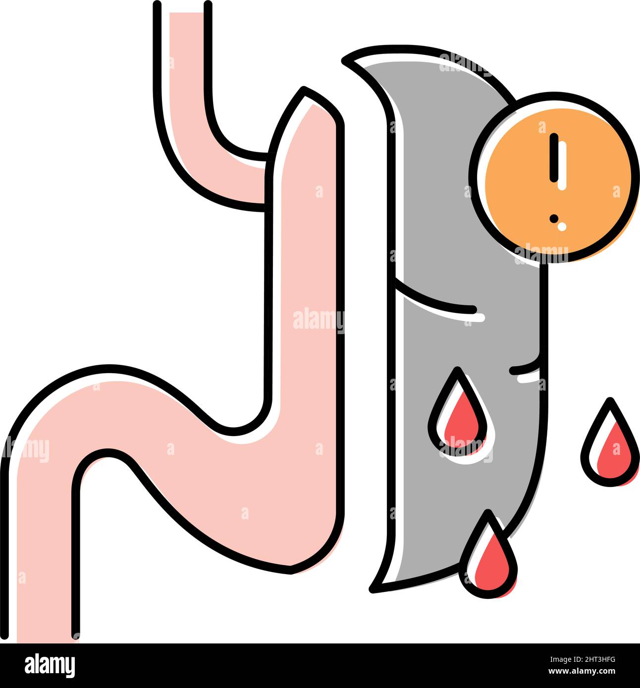 Gastrointestinal bleeding illustration Cut Out Stock Images & Pictures ...
