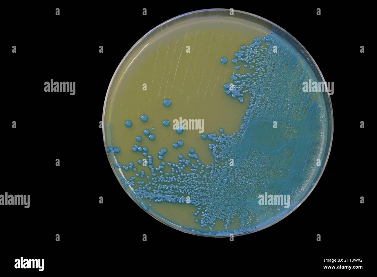 Listeria monocytogenes growing on an agar plate isolated on a black ...