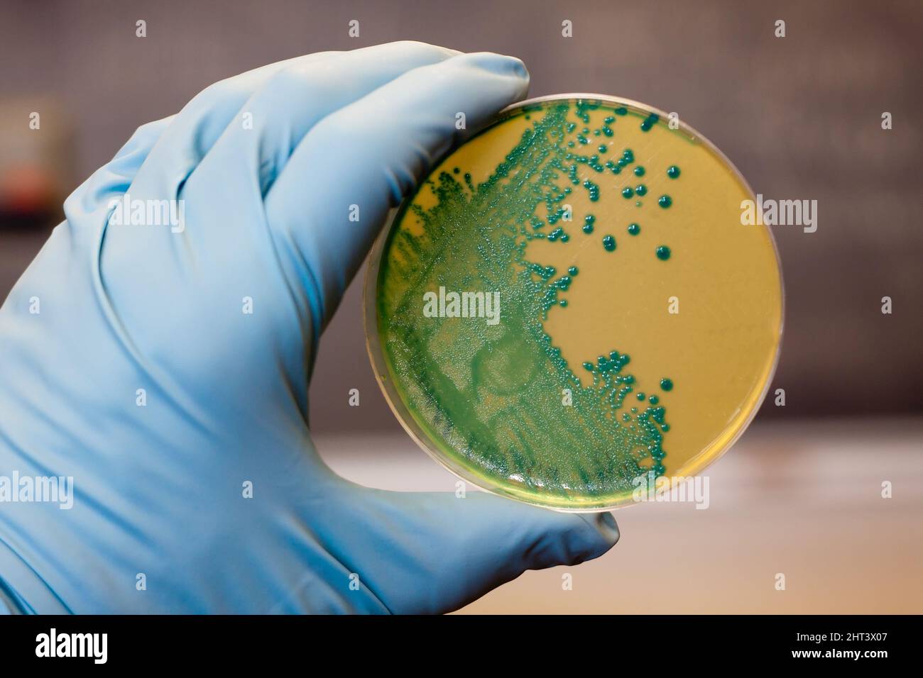 Listeria monocytogenes growing on an agar plate isolated on a black ...