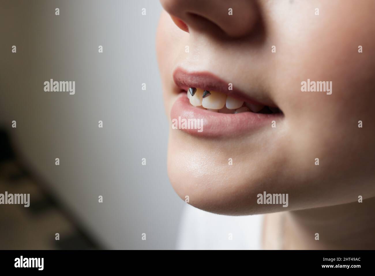 smile or frenulum piercing under the upper lip Stock Photo - Alamy