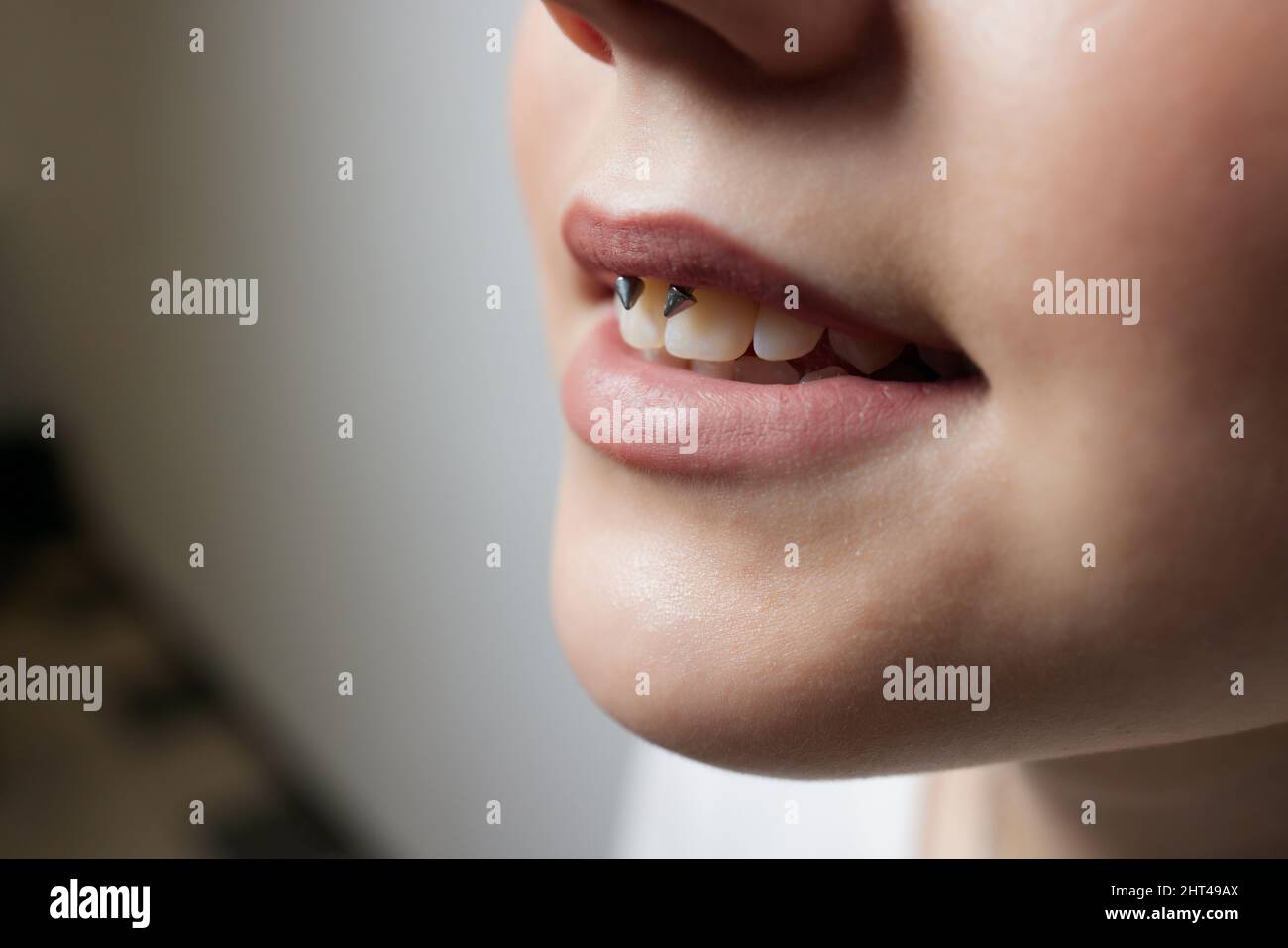 Upper Frenulum Piercing