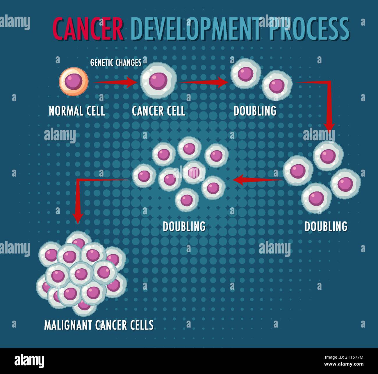 Cancer development process infographic illustration Stock Vector Image ...
