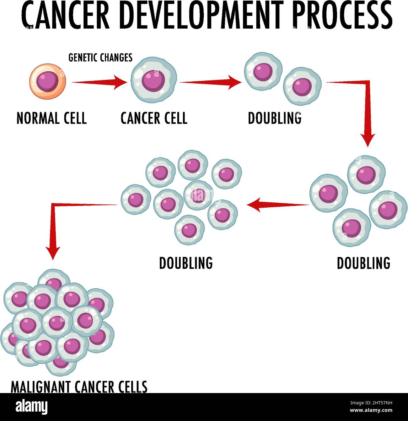 Cancer Devlopment Process infographic illustration Stock Vector Image ...