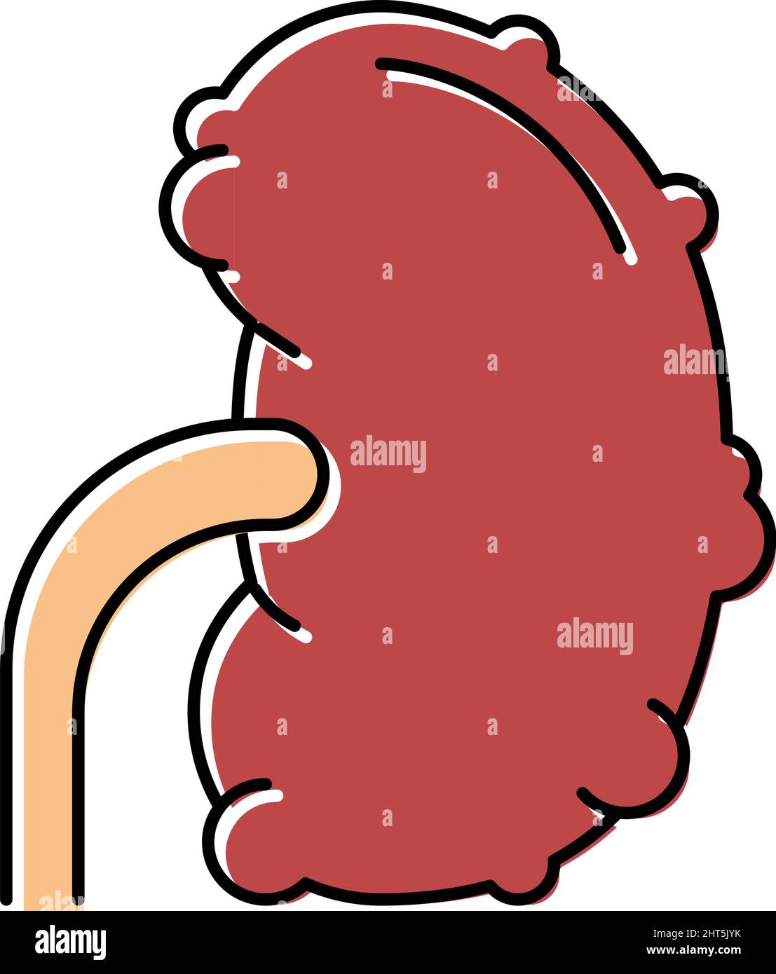 chronic pyelonephritis color icon vector illustration Stock Vector ...