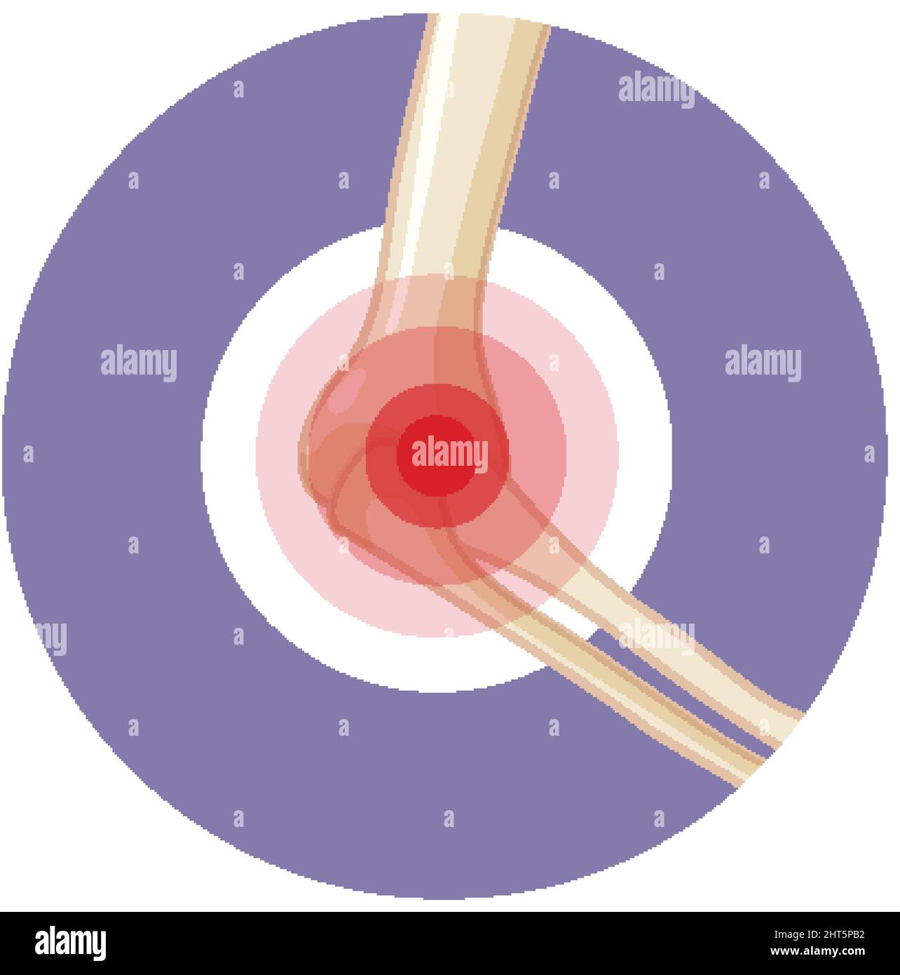 Elbow injury Stock Vector Images - Alamy