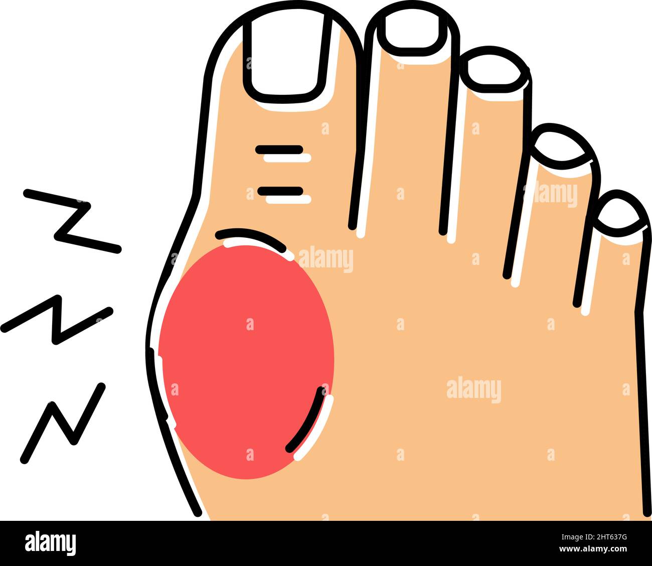 pain in big toe color icon vector illustration Stock Vector Image & Art ...