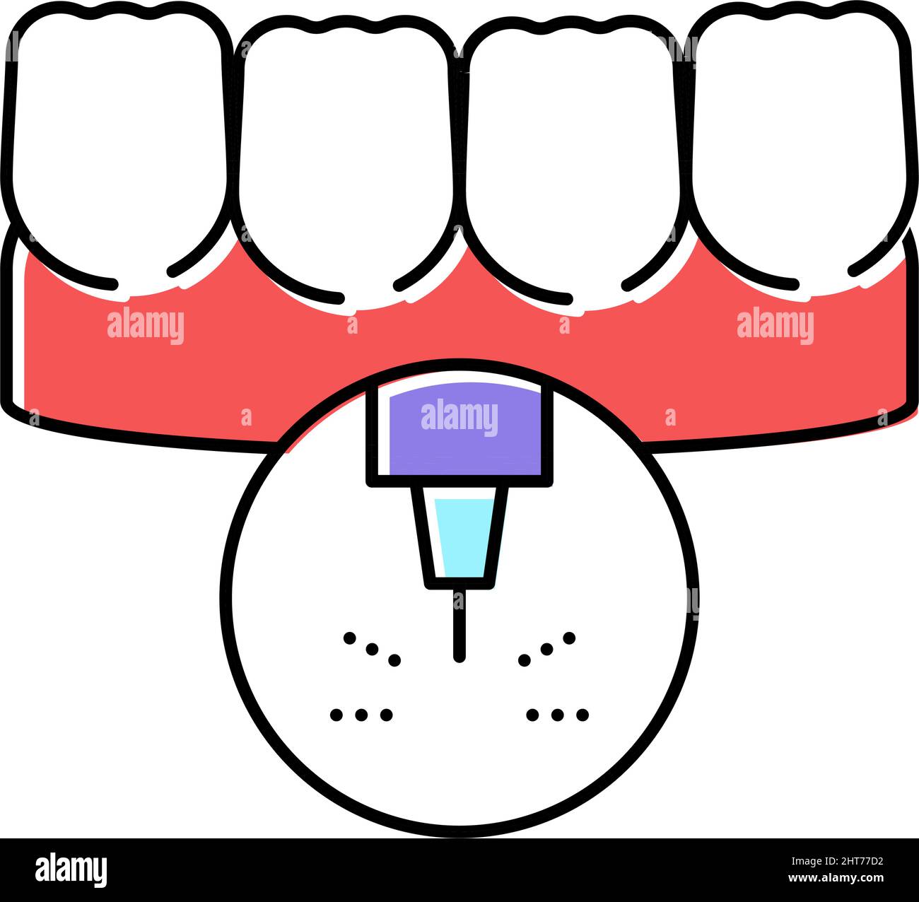stomatology teeth laser treatment color icon vector illustration Stock ...