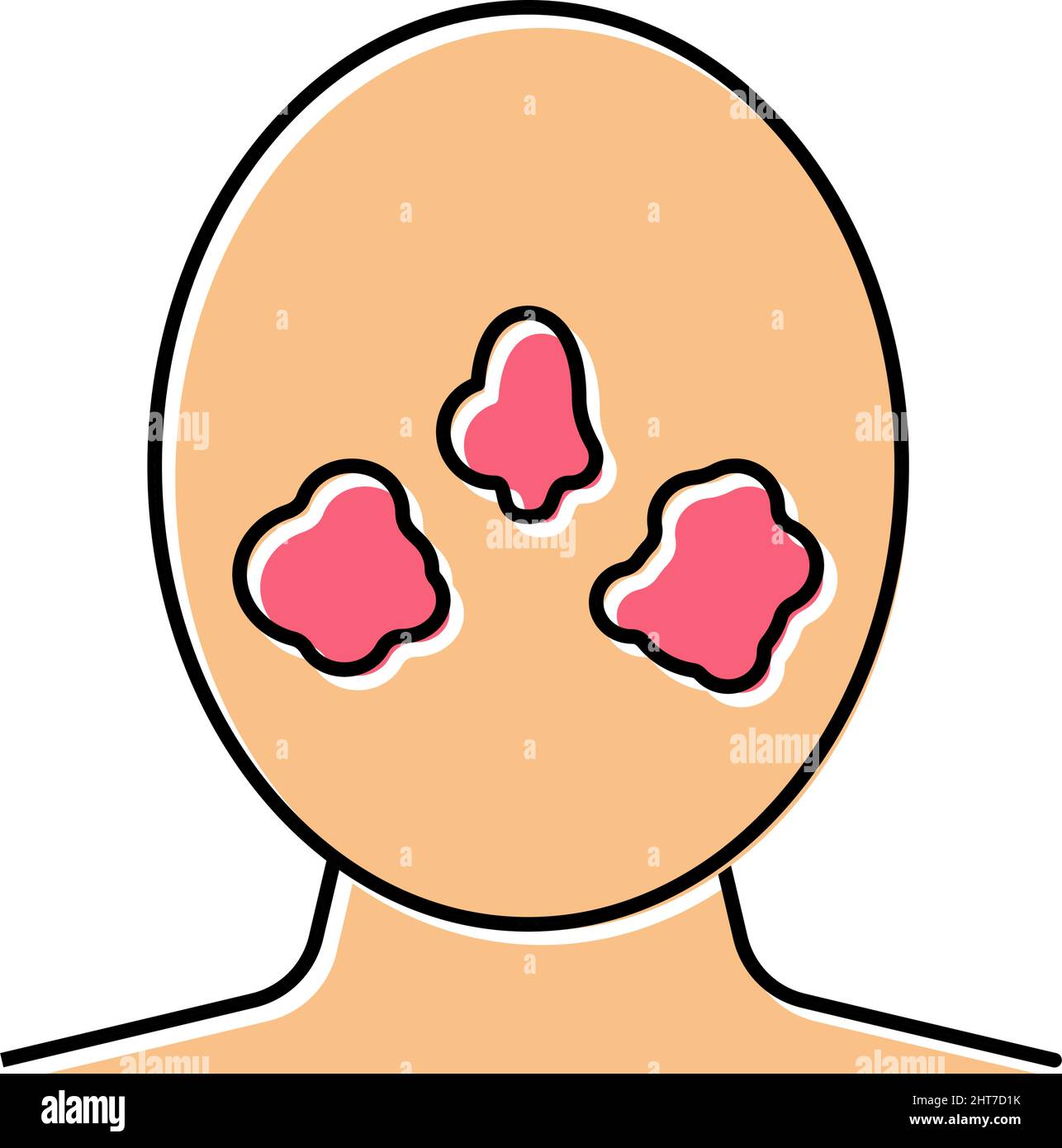 Rosacea Skin Disease Color Icon Vector Illustration Stock Vector Image