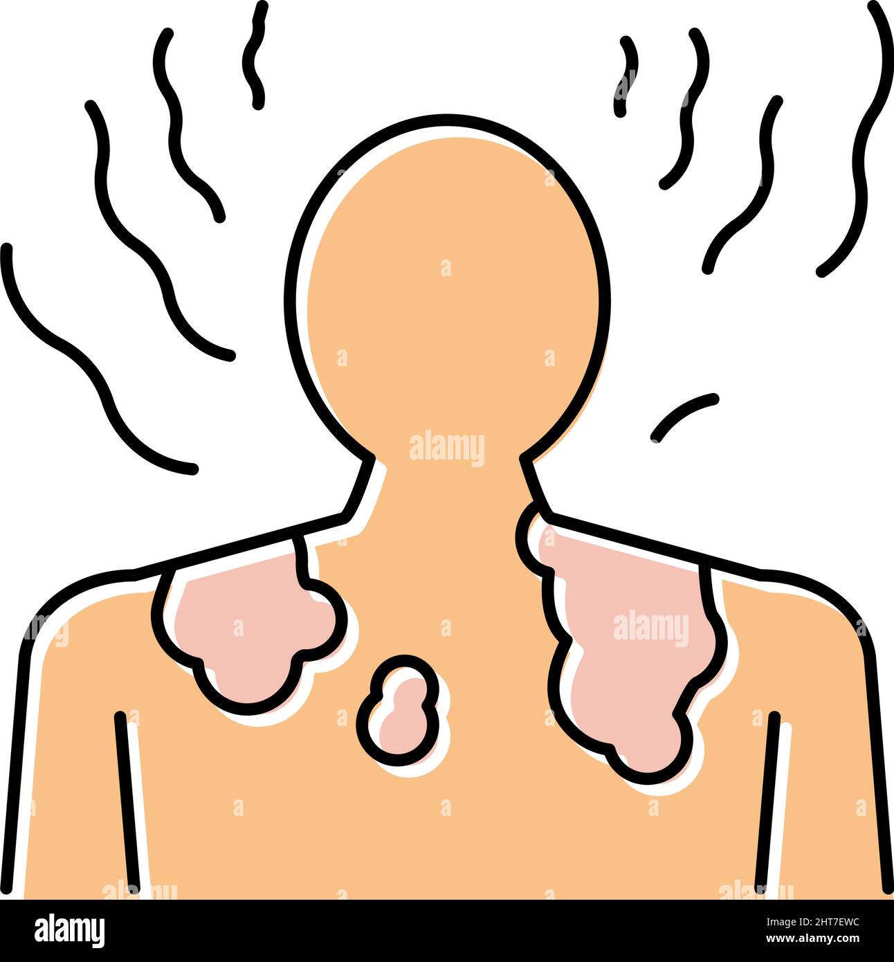 sunburn skin disease color icon vector illustration Stock Vector Image ...