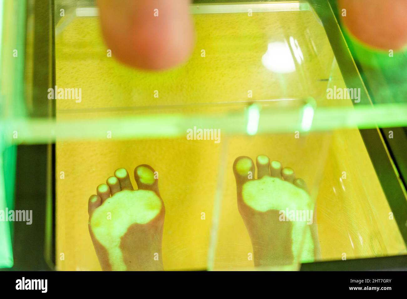 Female patient on a foot scanner in a podiatry clinic Stock Photo - Alamy