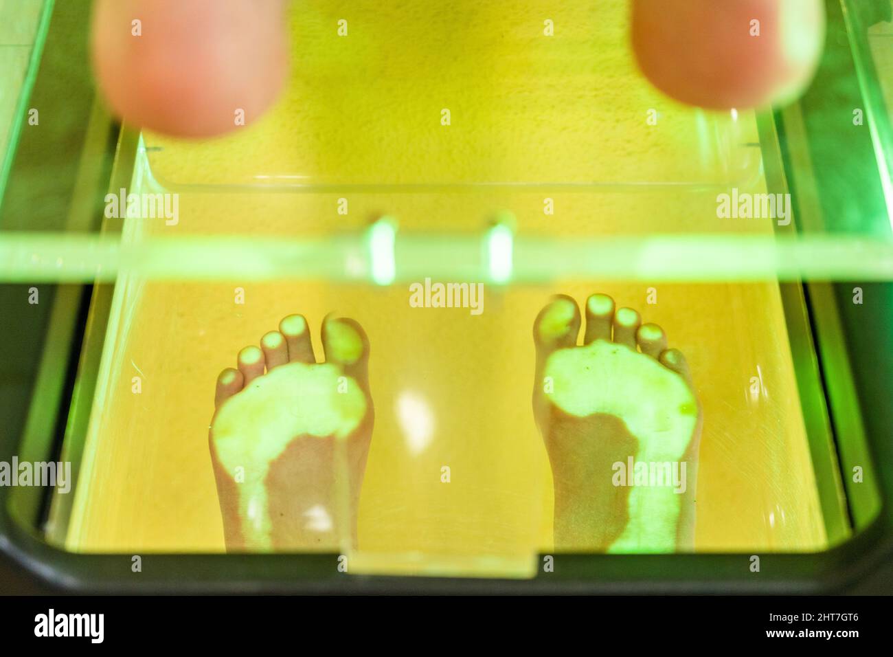 Female patient on a foot scanner in a podiatry clinic Stock Photo - Alamy
