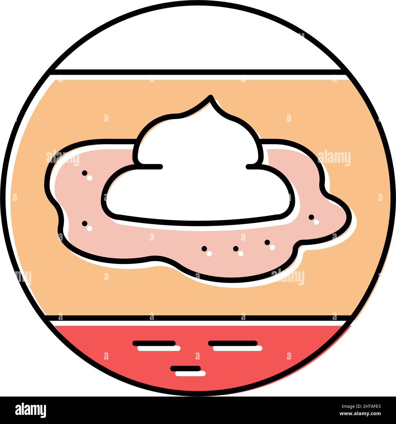 Dyshidrotic Eczema Cut Out Stock Images And Pictures Alamy