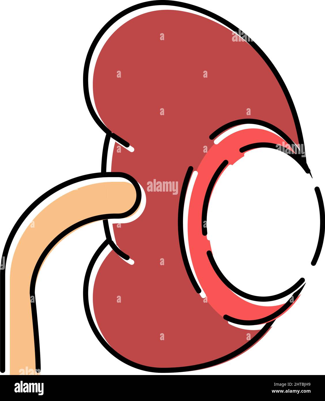 renal cyst color icon vector illustration Stock Vector Image & Art - Alamy