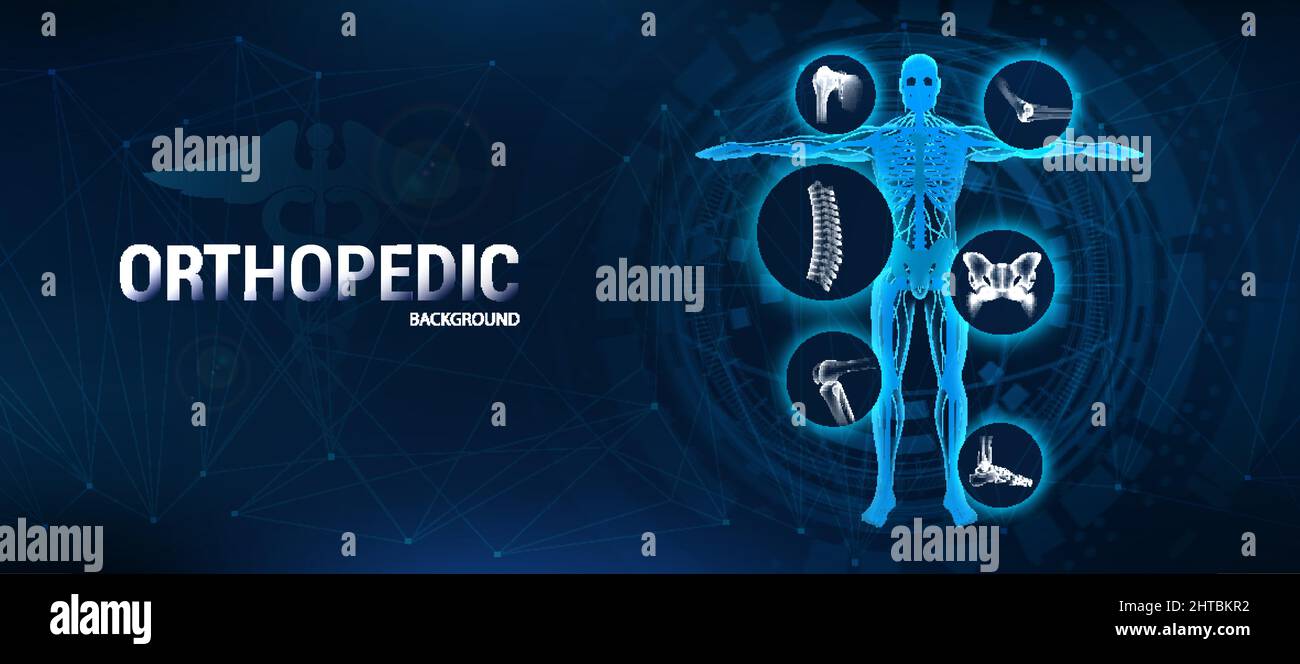 Rheumatology Medical banner. Vector orthopedic Stock Vector Image & Art ...