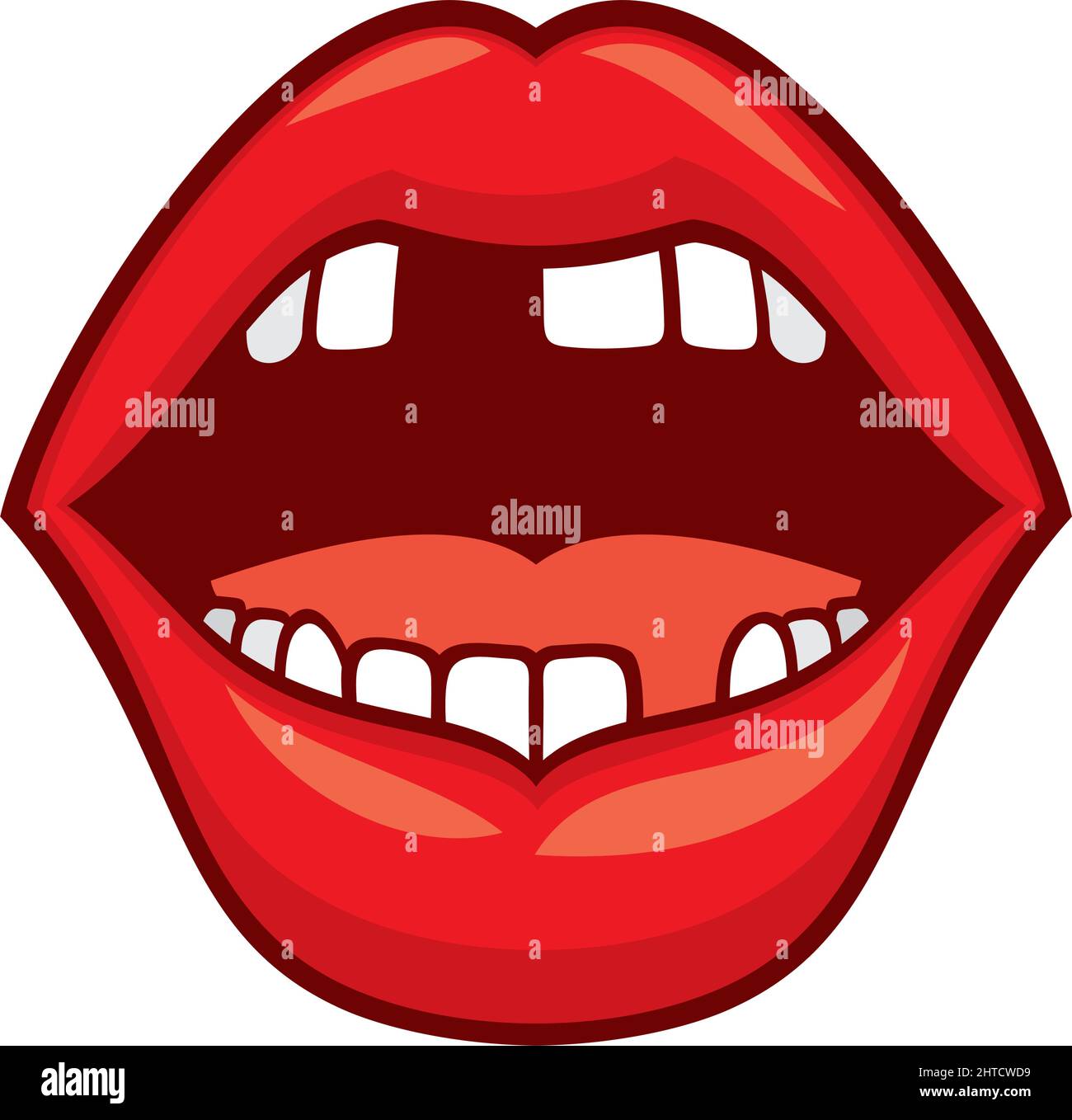Broken or lost teeth vector illustration Stock Vector Image & Art - Alamy