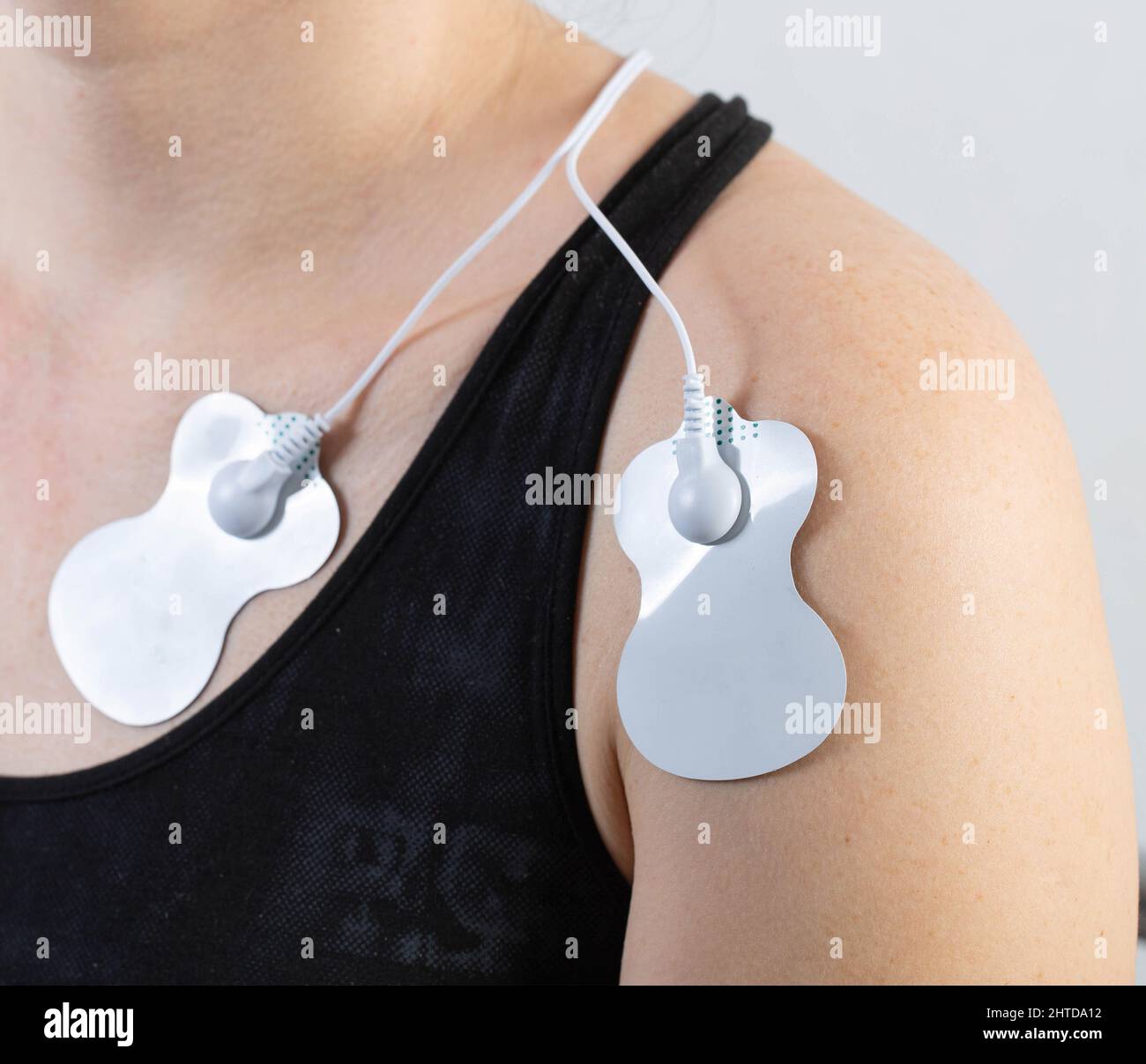 medical electric acupuncture massager on the body of a girl. Fat ...