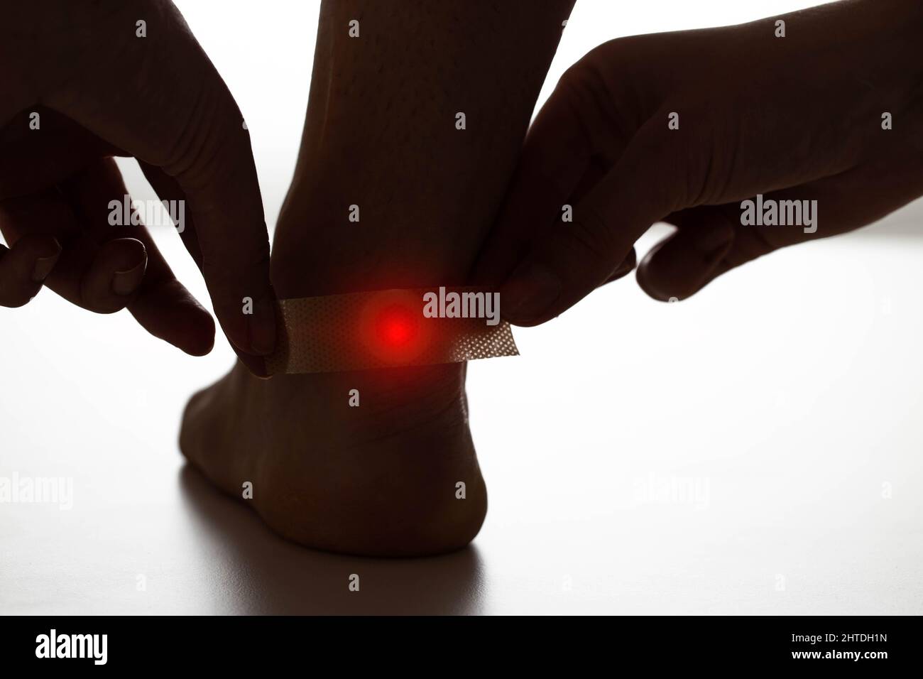 A girl sticks a medical plaster on her heel to treat calluses on her ...