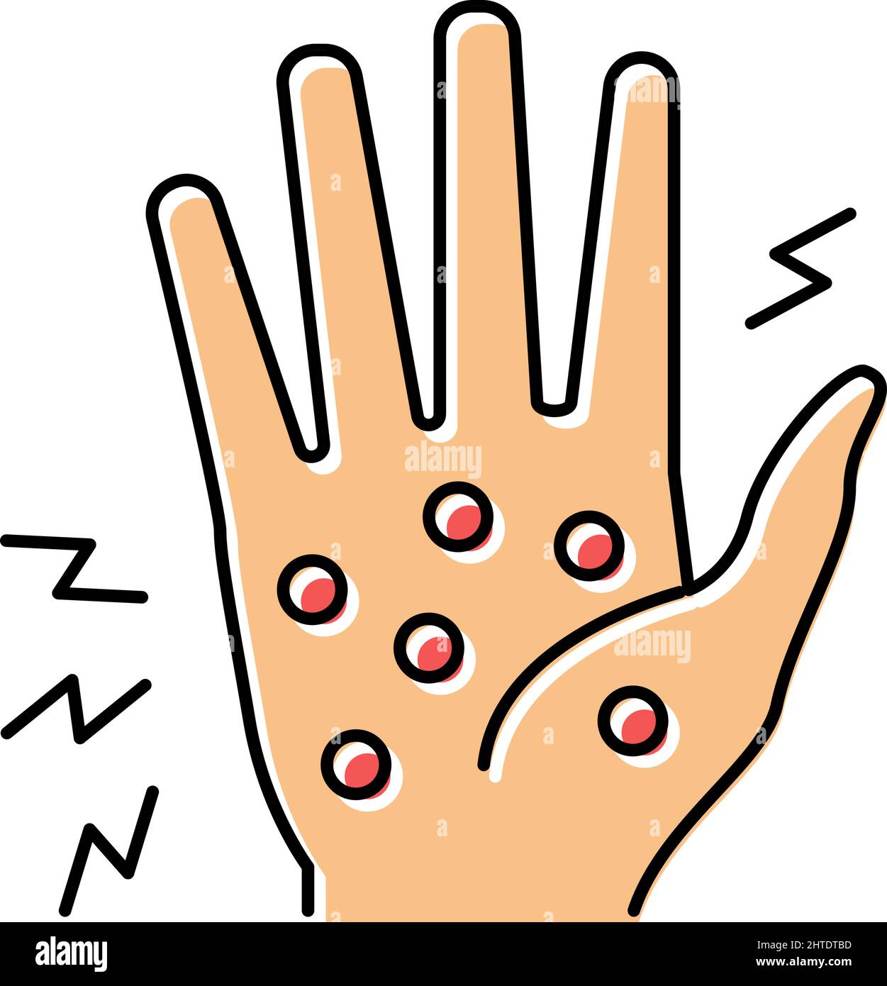 Dyshidrotic Eczema Color Icon Vector Illustration Stock Vector Image