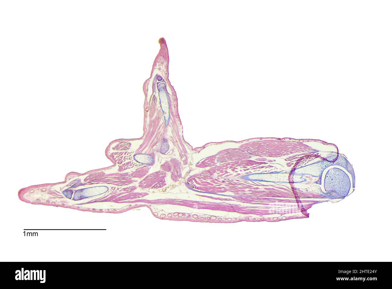 Tadpole Foreleg. Metamorphosis, A series of microscope slide sections ...