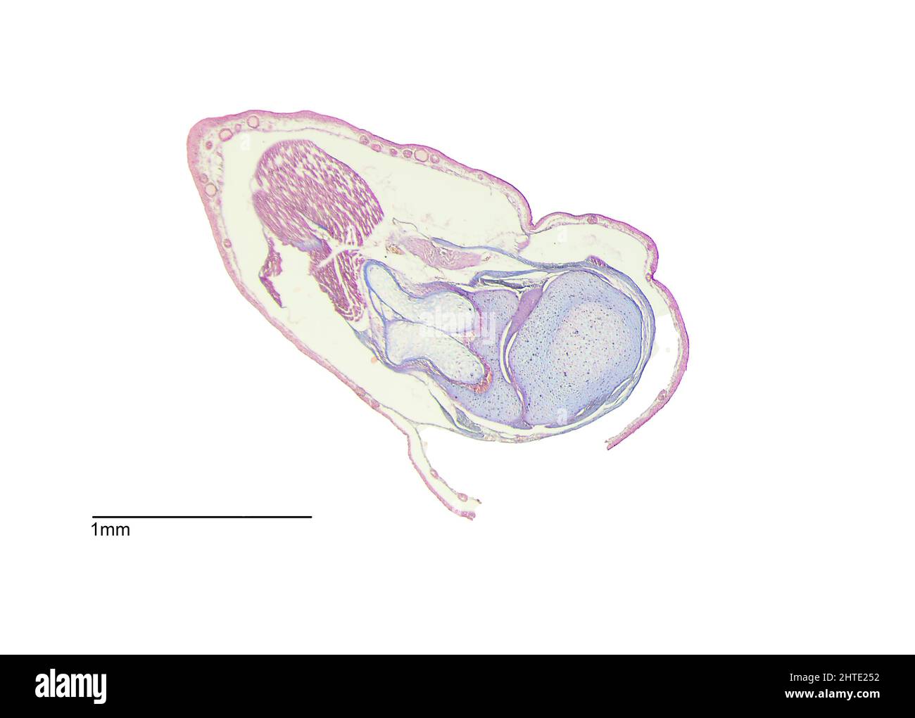 Tadpole knee, Metamorphosis, A series of microscope slide sections ...