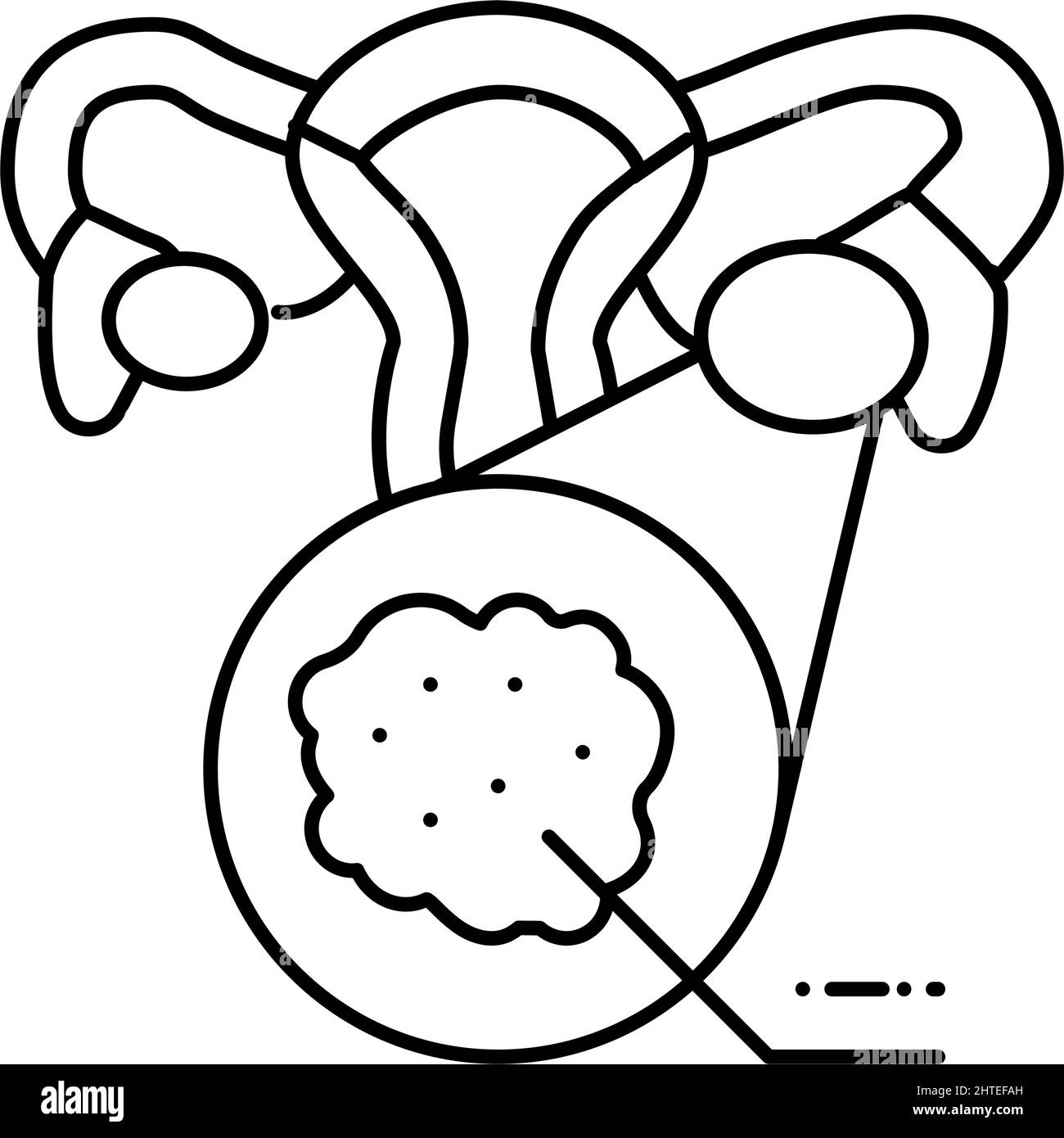 polycystic ovary syndrome endocrinology line icon vector illustration ...