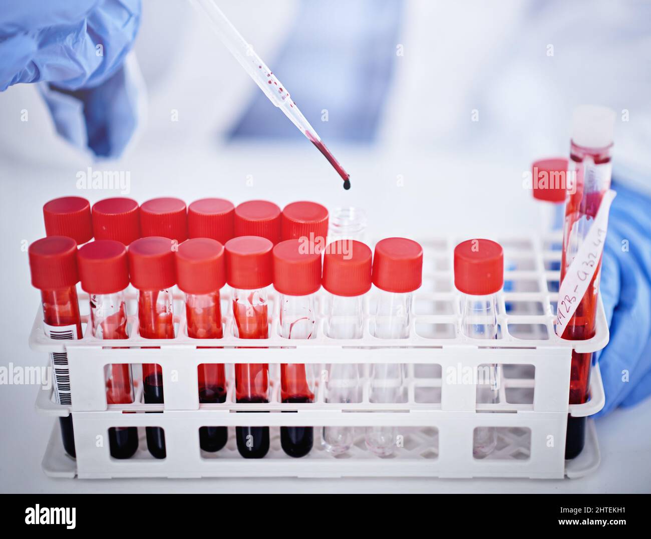 Vials blood hi-res stock photography and images - Alamy