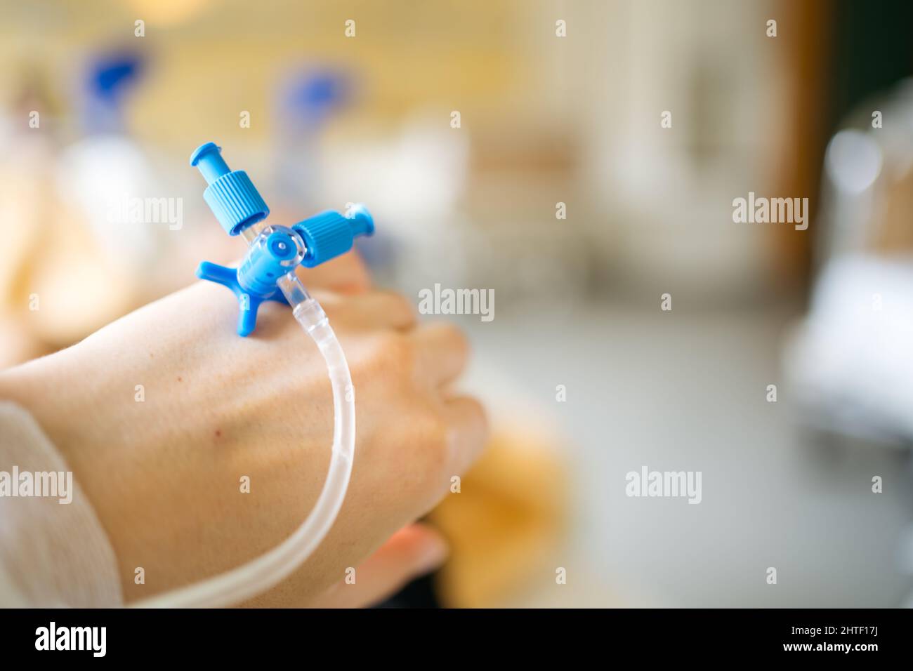 Young woman in the hospital after surgery Stock Photo - Alamy
